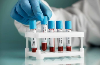 Blood Tests & Pathology Lab Services in India | HealthChek