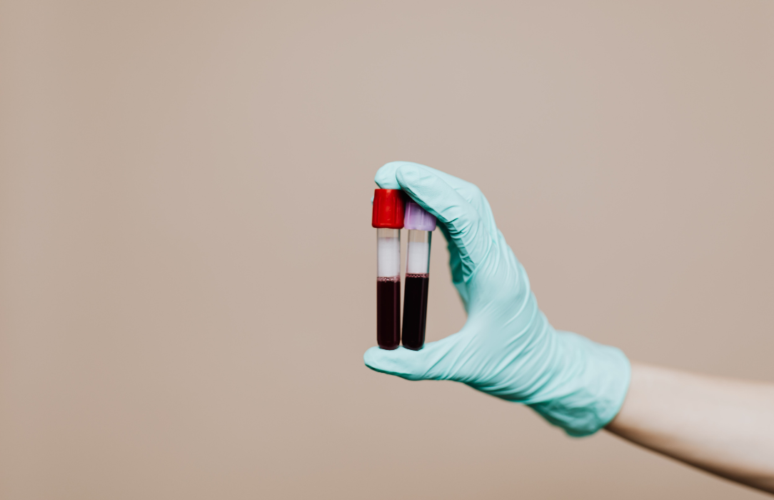 Blood Tests in India | Reliable Pathology Lab Services by HealthChek